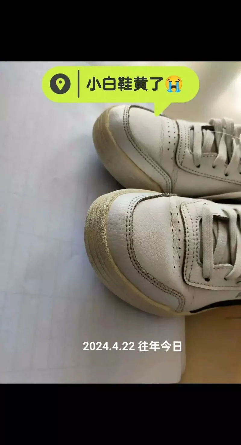 白胶鞋胶边发黄怎么办图标