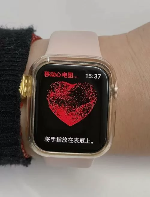 iwatch可以换电池吗图标