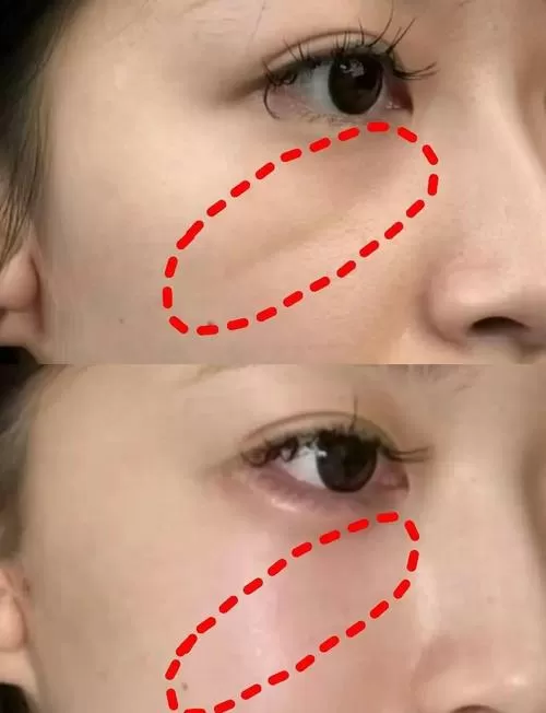 脸部的皱纹还能去掉吗图标