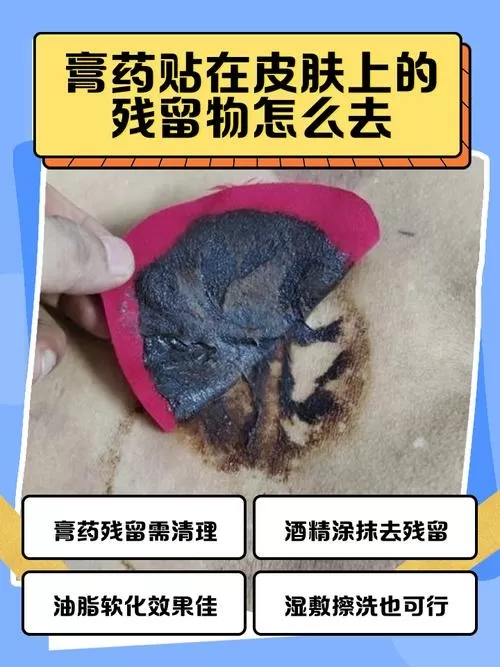 沾到身上的膏药怎么去掉图标