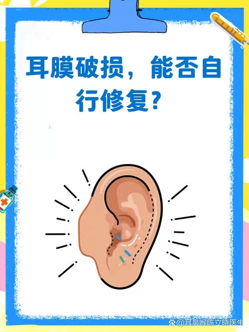 入耳式耳机的膜掉了怎么办图标