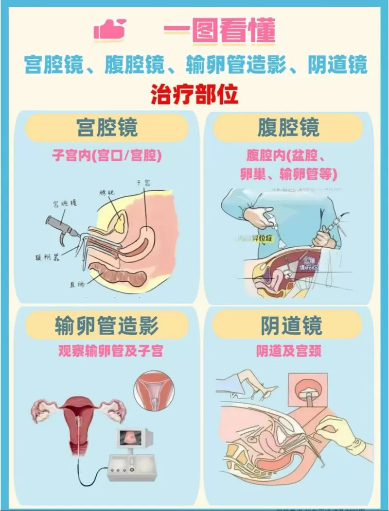 宫腔镜和腹腔镜哪个伤害小图标