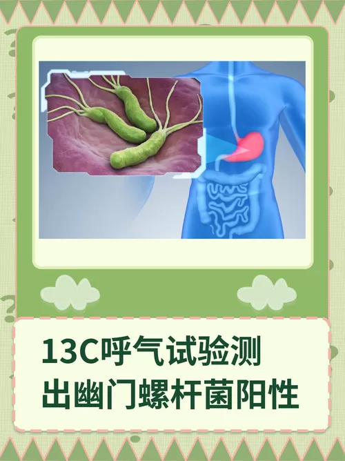 13c尿素呼气试验检查幽门螺杆菌截图