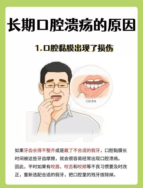 口腔溃疡的发病原因截图