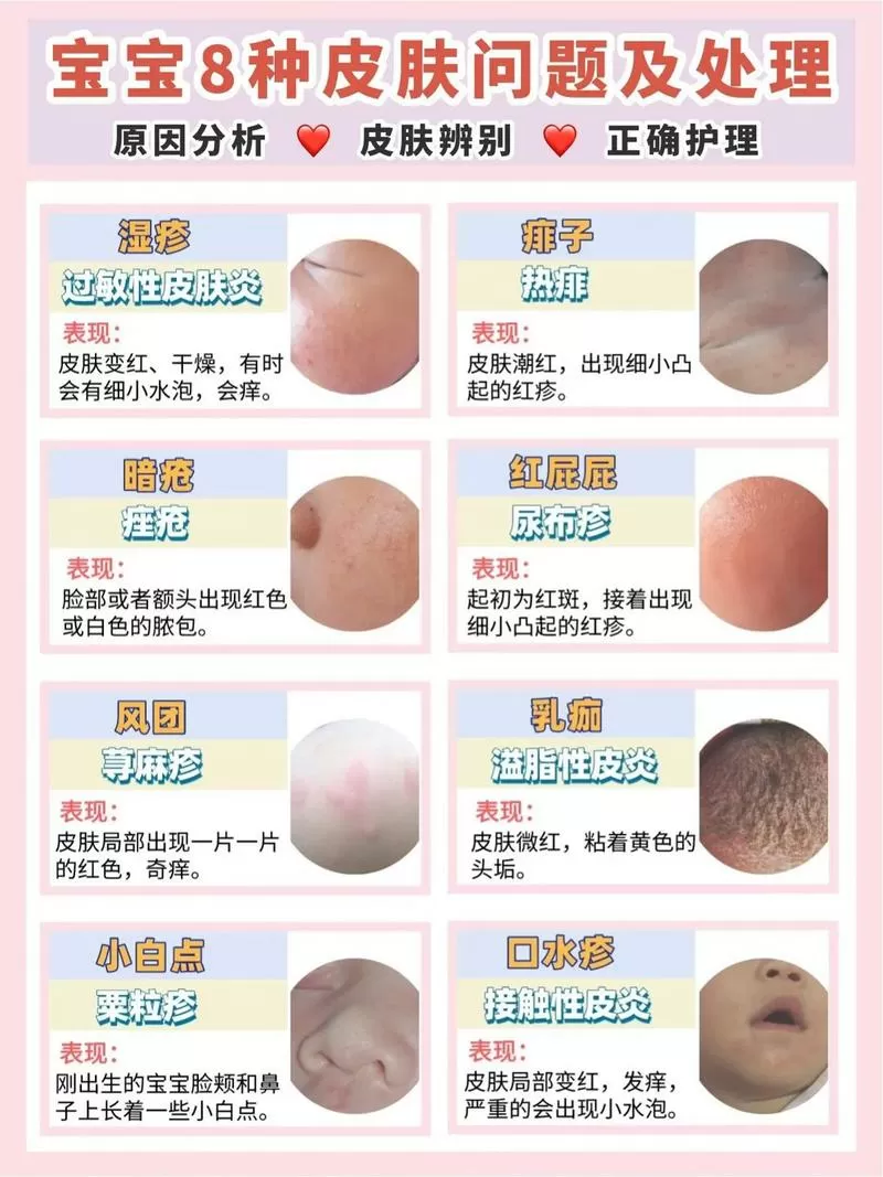 脸部起红包怎么回事图标