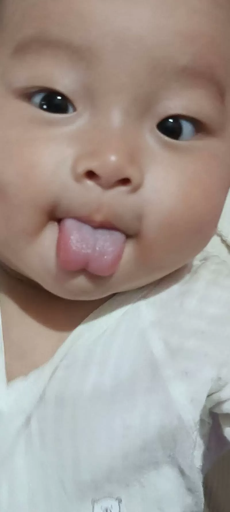 二个月宝宝吐舌头正常吗截图