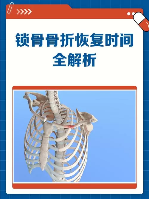 锁子骨断了多少天才能恢复截图