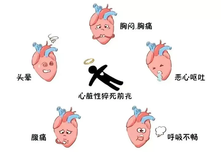 为何看起来健康的人会猝死图标