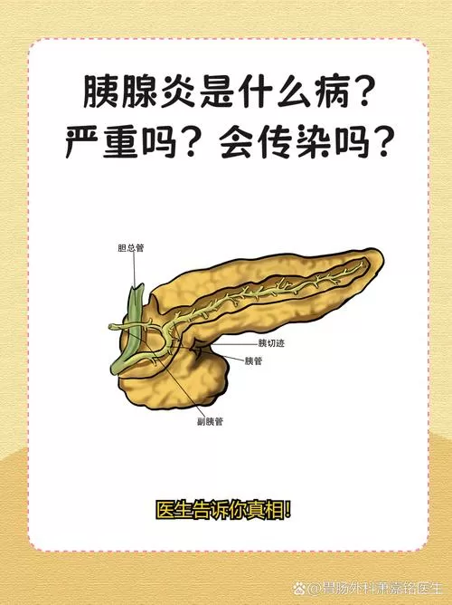 胰腺炎会传染夫妻吗图标