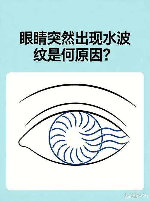 眼睛突然有水波纹闪光感一会就好了截图