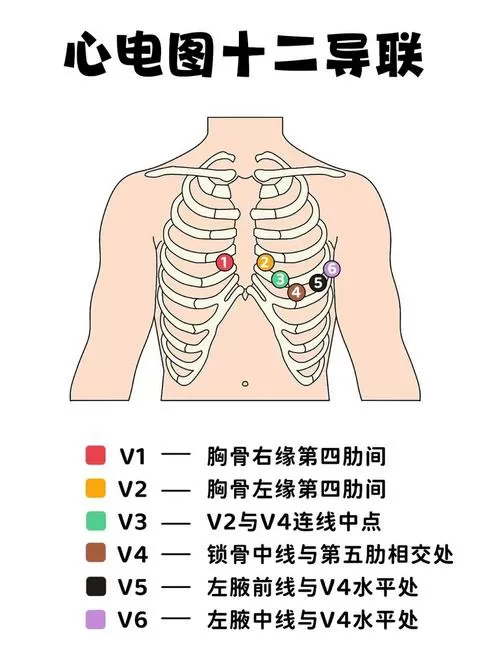 v1到v6导联位置截图