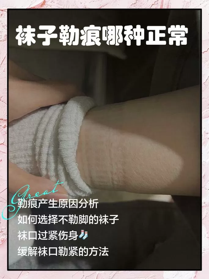 脚脖穿袜子勒的痒是怎么回事截图