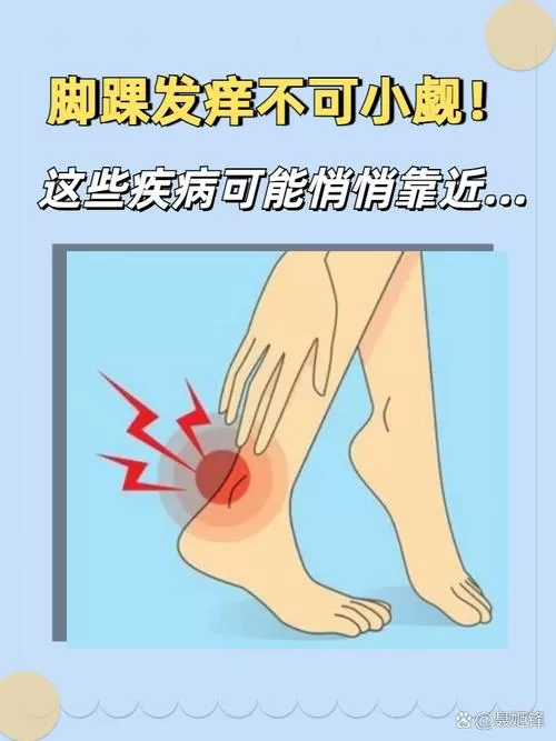 脚脖子痒痒怎么回事截图